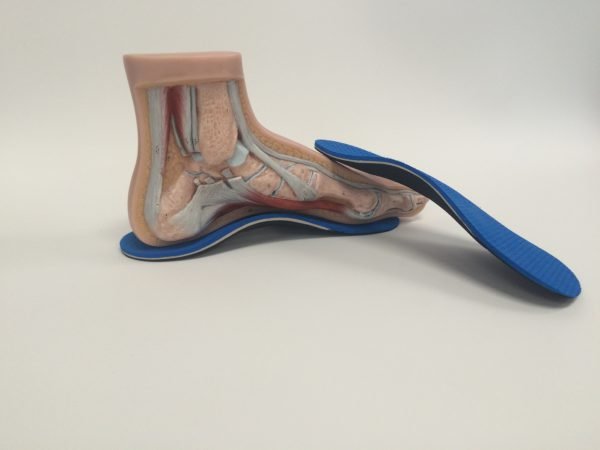 Custom Orthotics - Foot Management, Inc.